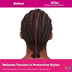 Matrix Instacure Tension Reliever Leave-In Scalp Serum | Moisturizes Dry, Irritated Scalp | Cools Tension in Braids, Protective & Tight Hairstyles | Scalp Pain Relief | 6.8 Fl. Oz. | Vegan