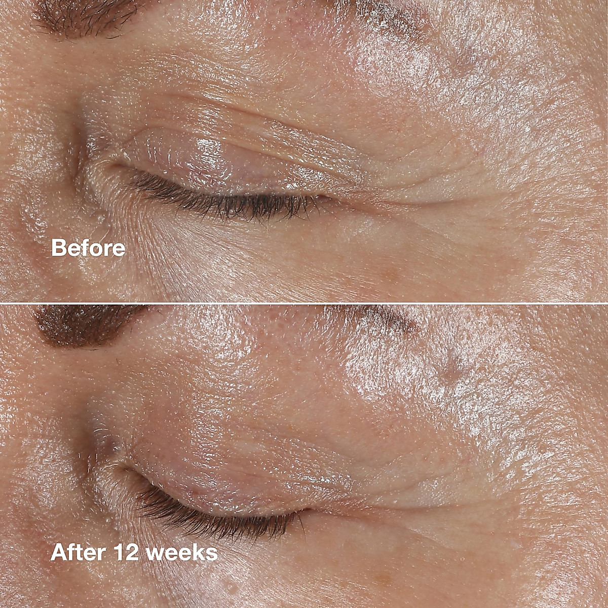 Clinique Smart Clinical Repair Wrinkle Correcting Eye Cream With Hyaluronic Acid + Peptides | Anti-Aging, Hydrating + Depuffing, Mini Travel Size, 0.5 fl. oz.