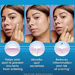 Clearasil Stubborn Acne Overnight Spot Pimple Patches, 18 Count (Pack of 6)