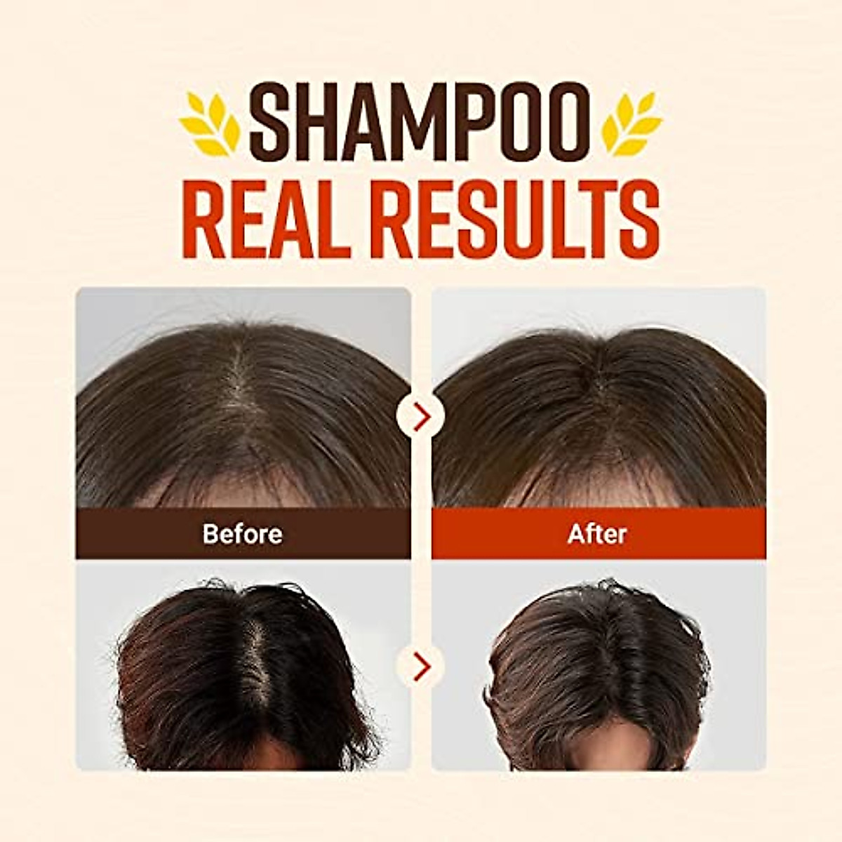 CRAZY SKIN Beer's Shampoo & Hair Pack 3.38 fl.oz Travel Size - Beer Yeast Biotin for Hair Regrowth, Thickening Protein, Keratin, Collagen - Repairing Damaged Tresses