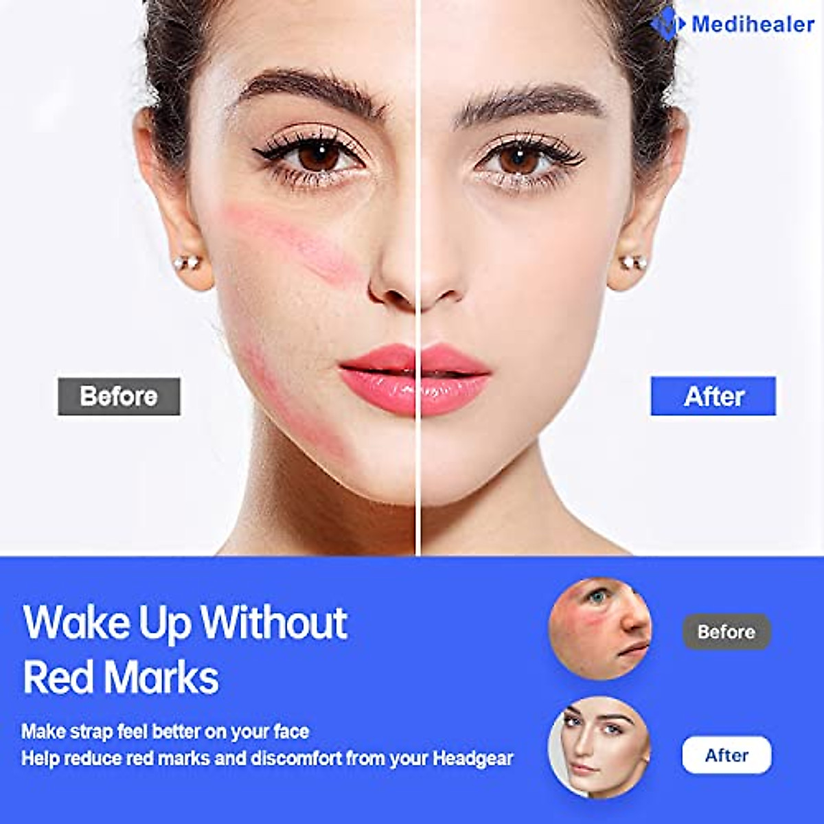 16 Pack Headgear Strap Covers, Universal and Reusable CPAP Strap Covers, Soft-Fleece Strap Pads for Reduce Red Marks, Great Value Kit Supplies by Medihealer