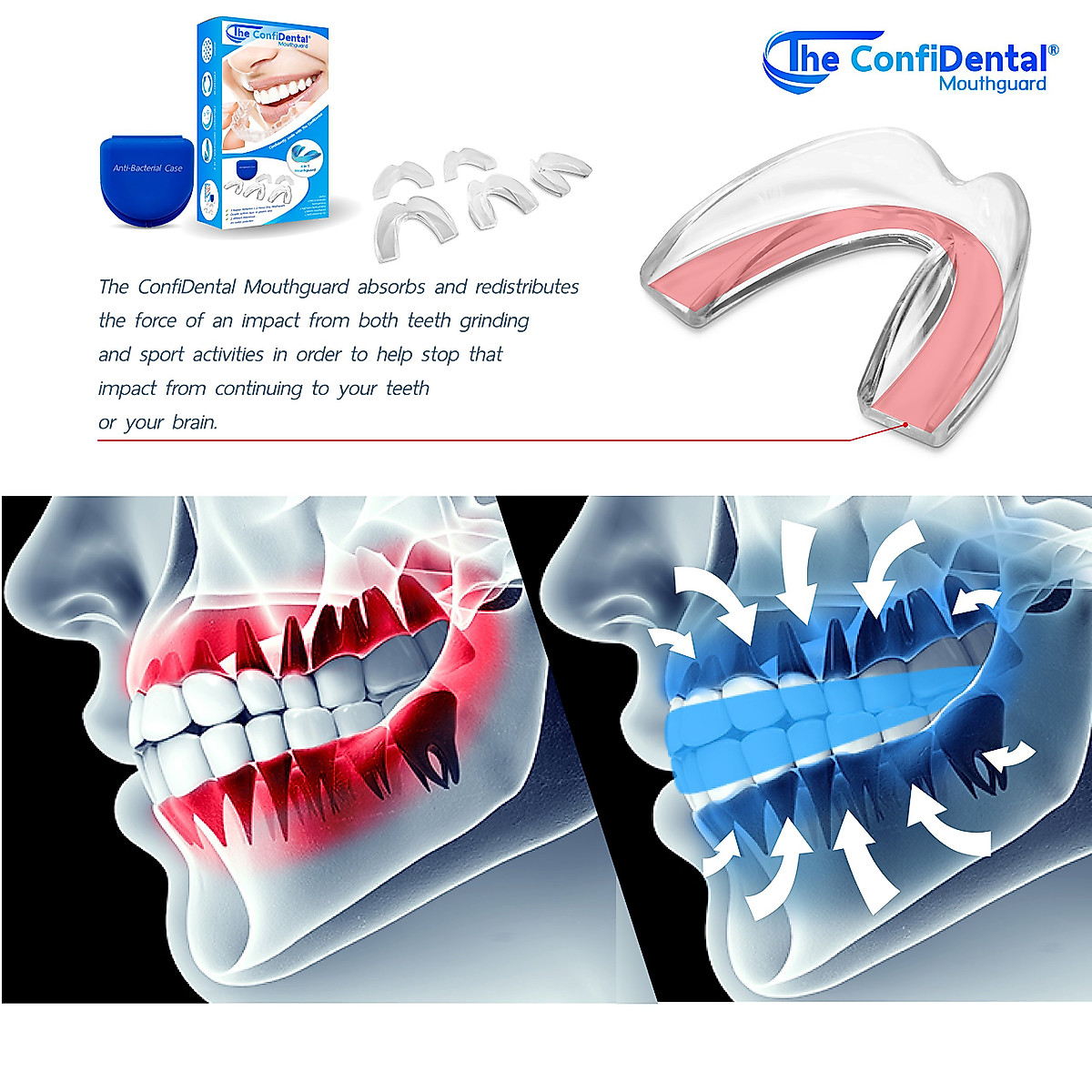 The ConfiDental - Pack of 5 Moldable Mouth Guard for Teeth Grinding Clenching Bruxism, Sport Athletic, Whitening Tray, Including 3 Regular and 2 Heavy Duty Guard (3 (lll) Regular 2 (II) Heavy Duty)