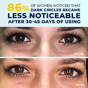 Under Eye Brightener for Dark Circles – 4 in 1 with Niacinamide, 5% Caffeine, Retinol & Peptides - Eye Cream Anti Aging for Reduce Wrinkles, Puffiness and Bags Under Eyes