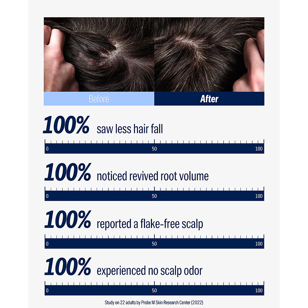 DASHU Revitalizing Protein Shampoo for Dry, Itchy Scalp, Thinning Hair, and Men - 16.9 fl oz