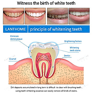 3PCs Frosty Neptune Teeth Whitening Pen,Teeth Whitening Essence,Teeth Whitening Gel,Teeth Stain Remover to Whiten Teeth,Intensive Stain Removal Teeth Reduce Yellowing