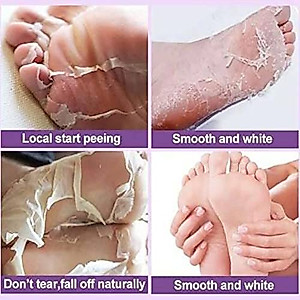 Foot Peel Mask (2 Pack) - Chracked Heel Repair, Dead Skin Remover for Baby Soft Feet - Natural Treatment