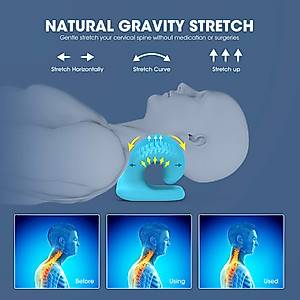 ZAMAT Neck and Shoulder Relaxer w/Magnetic Therapy Pillowcase, Neck Stretcher Chiropractic Pillows for Pain Relief, Cervical Traction Device for Relieve TMJ Headache Muscle Tension Spine Alignment