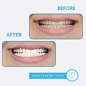 GO SMILE On The Go Teeth Whitening Pen, Teeth Whitener & Stain Remover Self Care Gifts for Women & Men - Whitening Strips Alternative - Travel Size for Gift Basket or Stocking Stuffers, Mint, 1.3mL