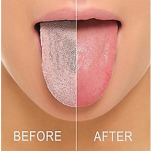 SUAVEC Liphontcta 4pc Random Colors Tongue Cleaner - Easy Grip Dual Head Tongue Scraper & Brush
