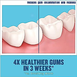 2PCS/50ML Toothpaste Foam,Mouthwash to Remove Dental Calculus, Oral Care to Eliminate Bad Breath