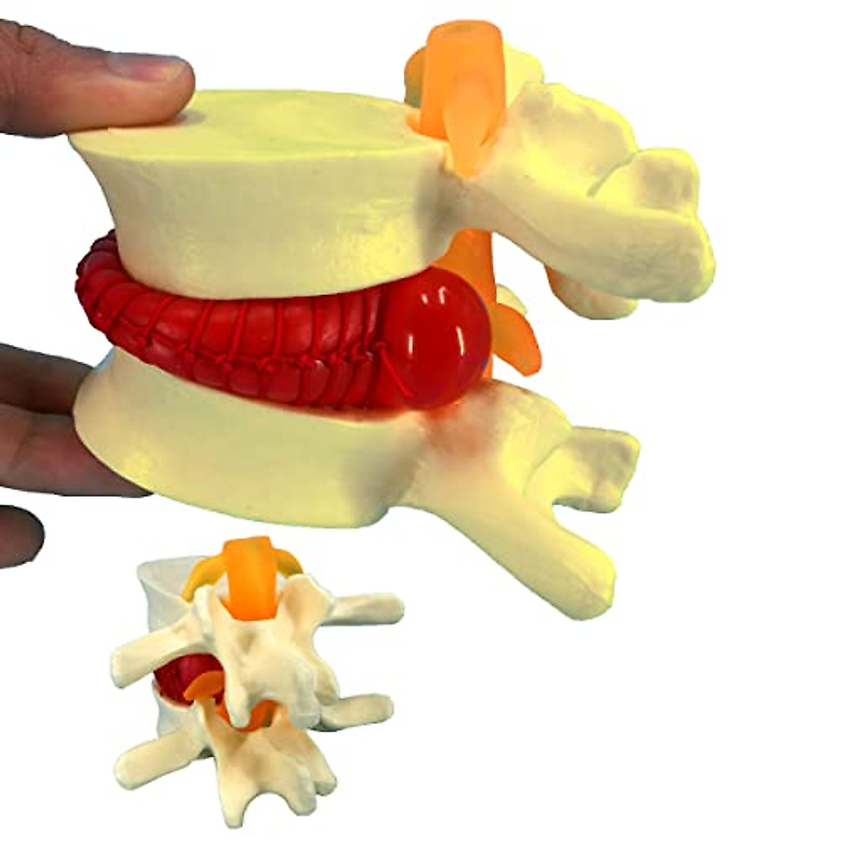 Veipho Human Anatomical Lumbar Disc Herniation Model, 1.5 Times Life Size Lumbar Disc Herniation Model, Human Lumbar Disc Herniation Model for Teaching, Learning, Demonstrating