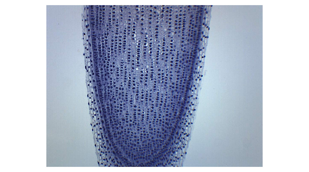 EISCO (Pack of 10) Allium Root Tip, Longitudinal Section - Prepared ...