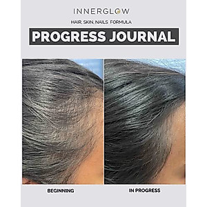 Inner Glow Advanced Hair, Skin & Nails Formula - Dermatologist and Plastic Surgeon Developed, clinically Tested for visibly Stronger and Thicker Hair in 12 Weeks