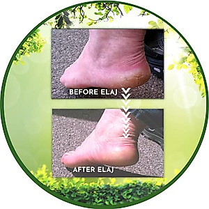 Elaj Pumice Stone Feet Scrubber - Natural Earth Lava Rock Foot Callus Remover for Smooth and Soft Feet, Exfoliates Dry, Cracked Heels & Skin, Promotes Foot Care Health, Designed for Women (Lava Rock)