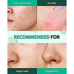 Glam Up - Calming Matcha Tea tree Clay Mask - Vegan Face Mask, Deep Cleansing, Calming Clay Mask for acne, Gentle Exfoliating Pore Purifying Skincare Face Mask, Acne Treatment, Blackhead remover - (125ml/4.23 Oz)