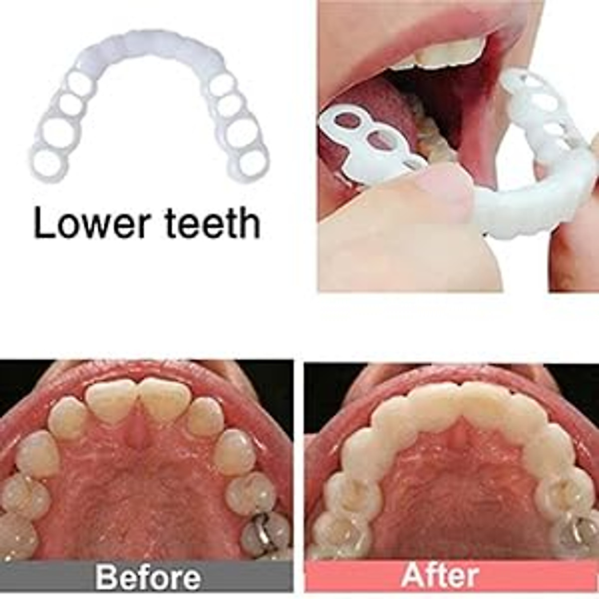 Renyqatt 2PCS Fake Teeth Adjustable Veneers Dentures Teeth for Women and Men Temporary Teeth Perfect Cover The Imperfect Teeth Nature and Comfortable (A)