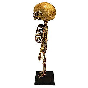 Asylum Zone Vintage Triclops 3-Eyed Baby Fetus Skeleton Fetal Specimen Oddity