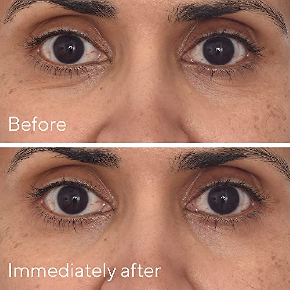 Murad Dr. Zion Retinol Youth Renewal Eye Masks – No-Slip Under Eye Patches for Fine Lines, Wrinkles, Crow’s Feet and Puffy Eyes - Full Absorption Treatment Strips, 5 Pairs