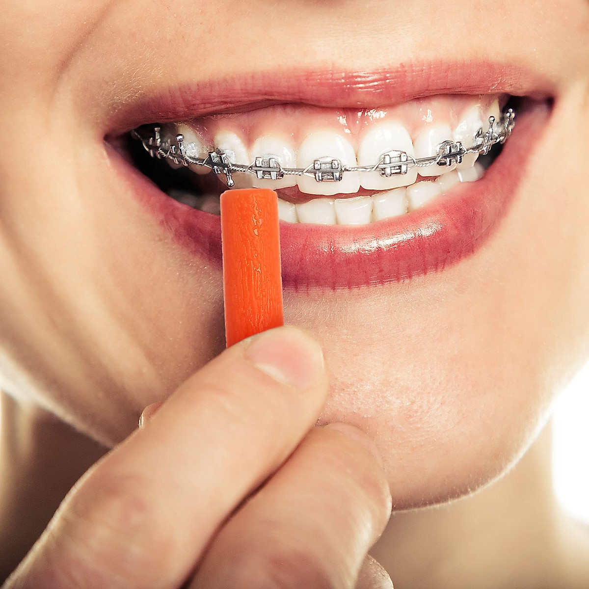 10 Pieces Aligner for Aligner Chompers Aligner Trays Seater Orthodontic Dental aligner(Orange)