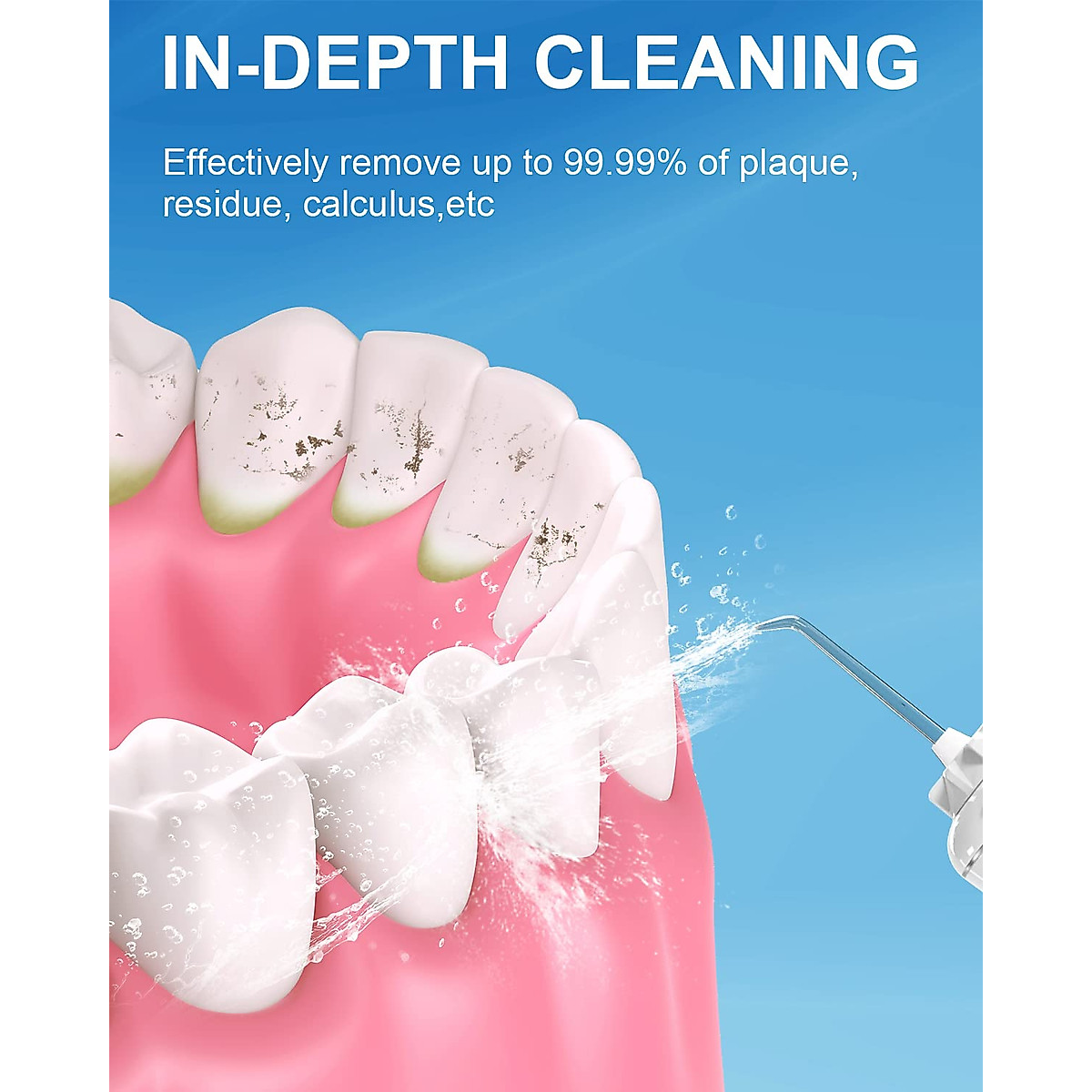 MySmile 10 PCS Replacement Jet Tips Oral Irrigator Nozzle Set Compatible with Waterpik Water Flosser, Includes Classic Tips Periodontal Pocket Tips and Plaque Seeker Tips