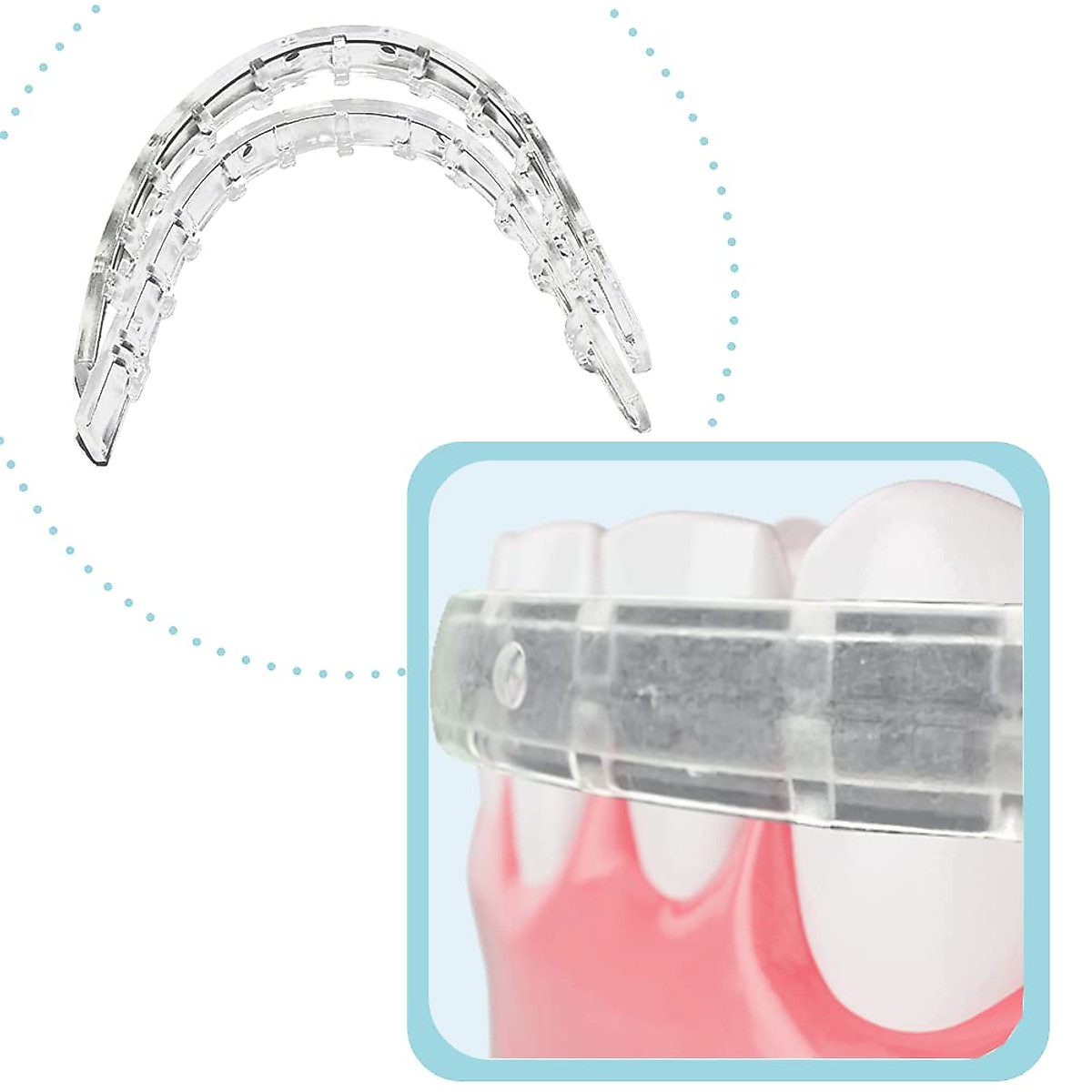 Comfort Cover for Braces, Lip Protector Mouth Guard Lip Cushion Teeth Shield Bumper for Brackets, Aligner, Dental Wax Alternative, Hard and Rigid Clip