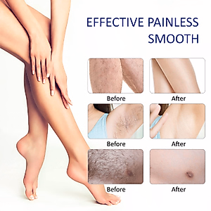 Hair Removal Spray Foam - Naturian Hair Removal Cream - Newest Formula Hair Removal with Aloe Vera & Vitamin E - Effective & Painless Depilatory Cream for Women & Men