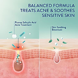 Cetaphil Face Moisturizer, Gentle Clear Mattifying Acne Moisturizer With 0.5% Salicylic Acid, Hydrates and Treats Sensitive Acne Prone Skin, Skin Care for Sensitive Skin, 3oz