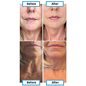 Neumi Skin 3.4 FL OZ Facial Spray (Nano-Formulated) with Glutathione, Collagen, and Hyaluronic Acid, Face Care & Firm, Pore Minimizer Face Spray, Reduce Fine Lines and Wrinkles, (1 Pack)