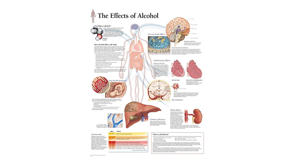 Effects of Alcohol Wall Chart for Health Education | Public Awareness