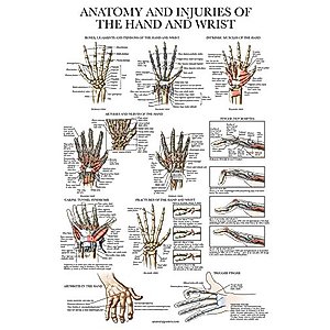 Laminated Anatomy and Injuries of the Hand and Wrist Poster - Hand and Wrist Joint Anatomical Chart - 18" x 24"