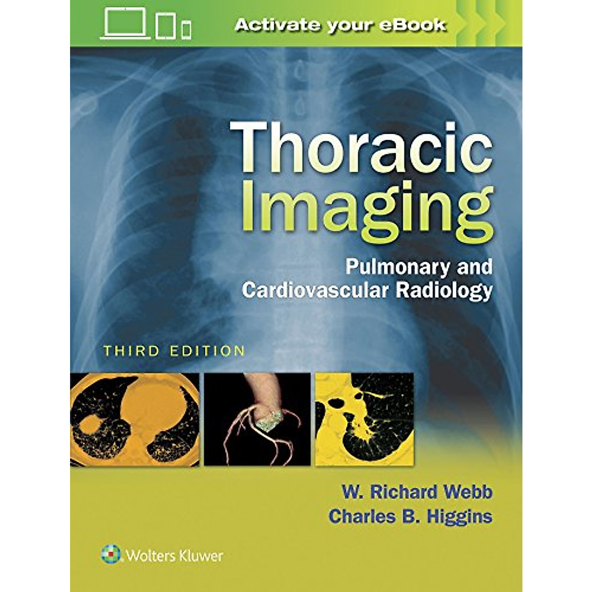 Thoracic Imaging: Pulmonary and Cardiovascular Radiology