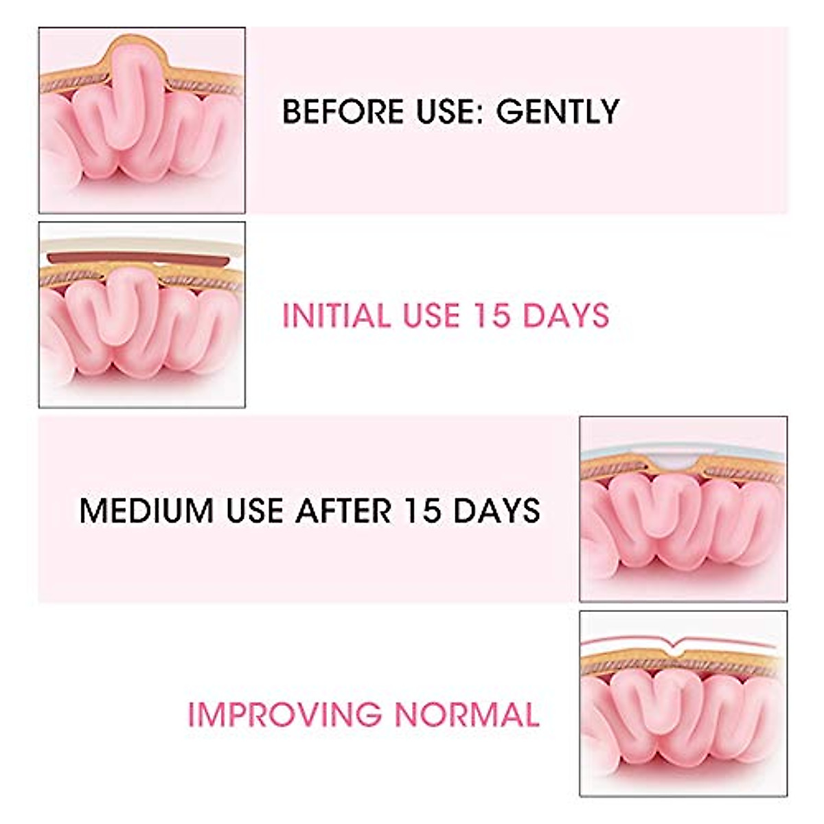 ZJchao Hernia Belt for Babies, 2-piece Hernia Belt Treatment For Hernia Therapy For Children Umbilical Hernia Belt for Newborns Infant Newborn Belt(Rosa)