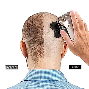 Head Shavers for Bald Men, Bald Head Shavers for Men, Head Shaver, Head Shavers for Men, Electric Head Shavers for Men, Head Razors for Bald Men, Bald Head Shaver, Head Shavers for Bald Men Wet/Dry