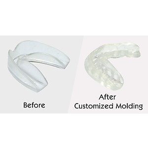Professional Mouth Guard for Grinding Teeth - 6 Customizable Dental Guards - 2 Sizes, USA Made, BPA Free, Eliminate Bruxism, Teeth Clenching, Also for Sports & Teeth Whitening
