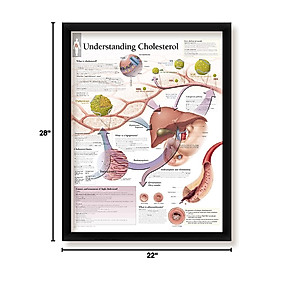 Set of 4 Framed Medical Posters Understanding Diabetes Understanding Cholesterol Understanding Metabolic Syndrome and Understanding Hepatitis 22"x28" Wall Diagrams
