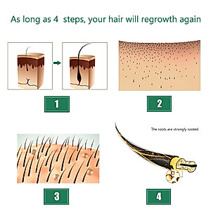 5 PACK Ginger Oil for Hair Growth,Hair Growth Serum,Biotin Hair Growth Oil,Hair Growth Ginger Serum for Men and Women,Hair Growth Treatment,Hair Loss Treatment,Promotes Thicker,Growth Hair