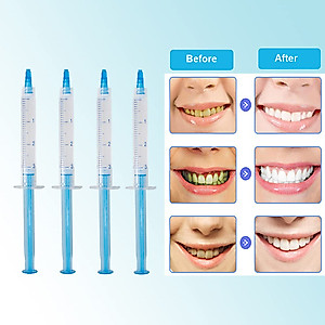 Professional Teeth Whitening Gel 10 PCS 3ML Sensitive Tooth Whitener Gel Syringes Refills 35% CP Bleaching Gel for Teeth Whitening Light