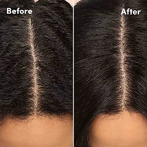 Mizani Scalp Care Calming Scalp Lotion |Dandruff Treatment | Nourishes & Soothes Scalp | For Curly Hair | 4 Fl Oz