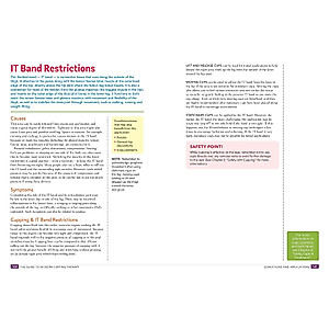 The Guide to Modern Cupping Therapy: Your Step-by-Step Source for Vacuum Therapy [Spiral-bound] Shannon Gilmartin