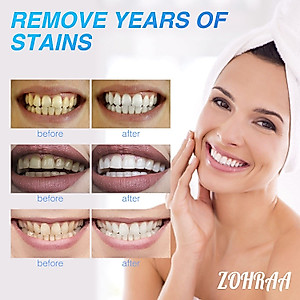 ZOHRAA Teeth Whitening Pen(2 Pens) - Effective & Painless Whitening - Perfect for Sensitive Teeth - 35% Carbamide Peroxide, No Sensitivity, Travel-Friendly, Natural Mint Flavor