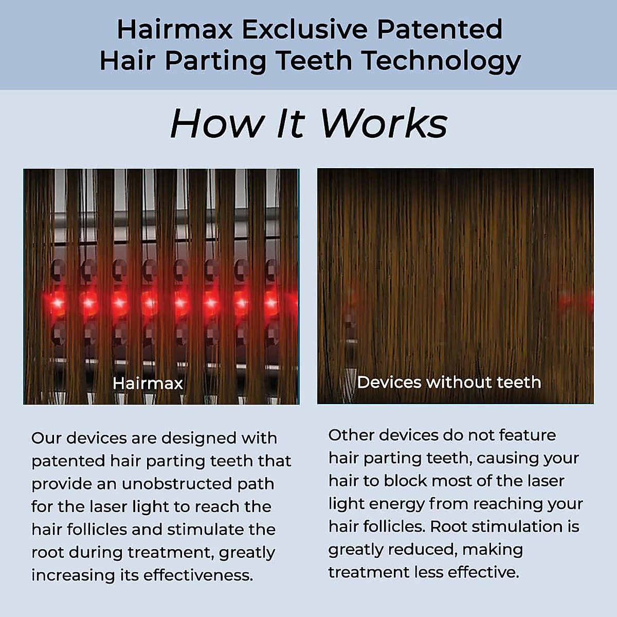 Hairmax Ultima 12 LaserComb - (FDA Cleared) Laser Hair Regrowth Treatment Device for Men & Women - Reverses Thinning Hair Loss - Red Light Therapy to Stimulate Hair Growth - Cordless Design