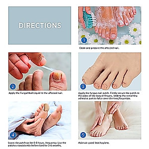 Toenail Fungus Treatment Extra Strength - Nail Fungus Treatment For Toenail, Toe Nail Fungus Treatment Extra Strength, Nighttime Fungal Nail Patches &amp; Fungus Nail Treatment Liquid Set (21patches+15ml)