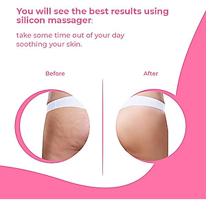 Cellulite Remover Anti Cellulite Massager Roller - Anticellulite Fascia Blaster for Cellulite Treatment - Improves Fat Deposits Use Cellulite Brush & Cellulite Roller with Cream or Oil