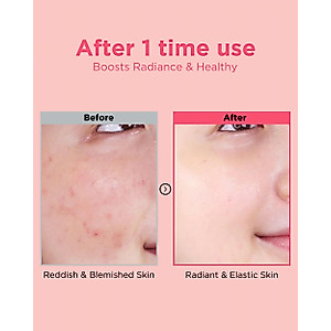 Easydew Re-DERMA Master Ampoule Award-Winning Anti Aging EGF Serum for Face/Neck/Eyes-14 Vials…