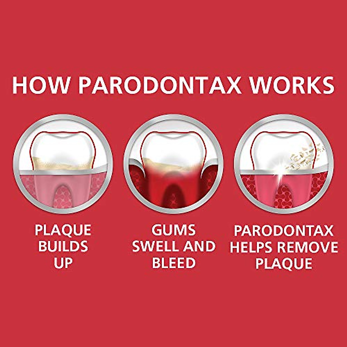 Parodontax Toothpaste for Bleeding Gums, Gingivitis Treatment and Cavity Prevention, Clean Mint - 3.4 Ounces