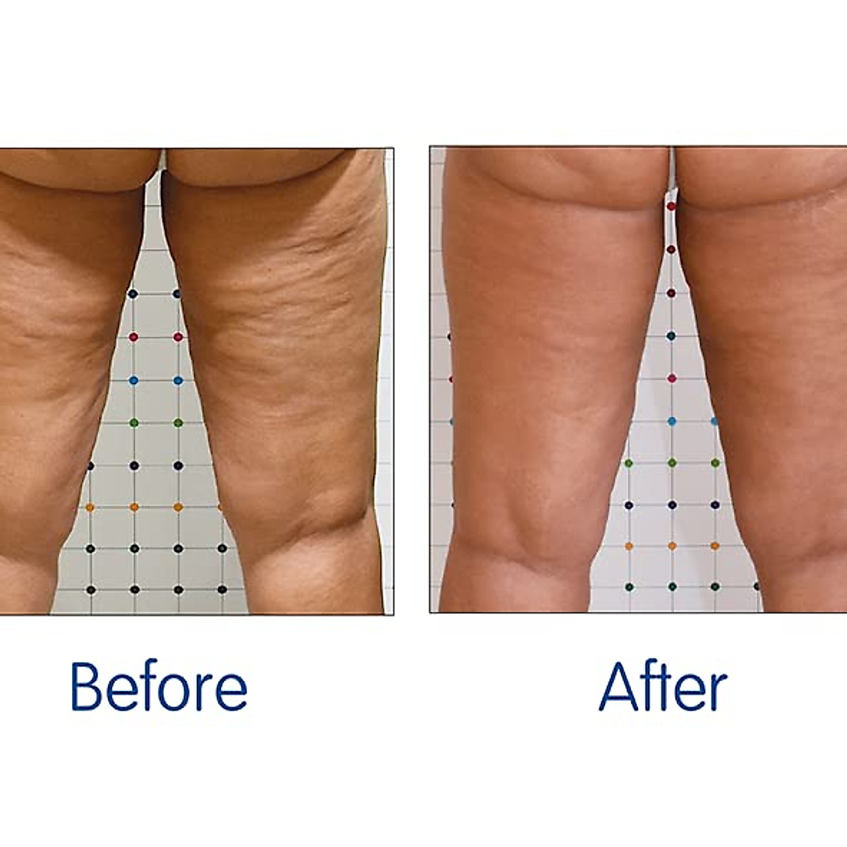 Organic Hair Solution-CELLULITE & STRETCH MARKS CREAM- Advance Formula Maternity Cream- With Neem, Cedarwood, Aloe vera Jojoba seed, Vitamin E,avocado oil, castor oil, green tea oil