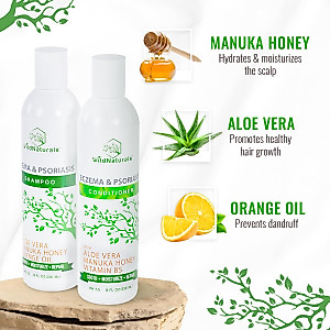 Wild Naturals Eczema Shampoo & Conditioner Set for Men & Women - Anti Dandruff Shampoo for Dry Scalp & Hair - Soothing Relief for Itchy Scalp - Psoriasis Shampoo for Scalp Treatment