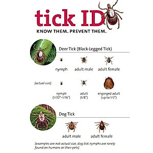 Tick Remover Tool for Dogs, Cats, and Humans - Painlessly Remove Ticks in Seconds - Set of 3 Tick Hooks, Including Storage Box