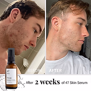 47 Skin Hydrating Face Serum for Clearing Acne & Scars, Anti-Blemish & Scar Repair Serum Skincare Treatment with Silver Chitoderm - Smooth Skin Moisturiser Facecare Serum for All Skin Types (1.01 oz)