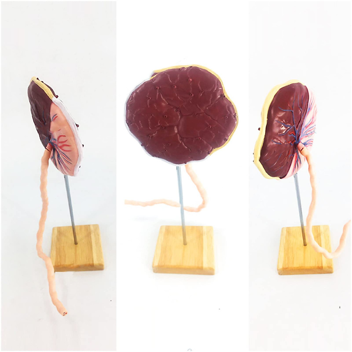 KH66ZKY Human Placenta Umbilical Cord Model - Reproductive System Anatomical Model - Human Internal Organs Medical Educational Training Aid